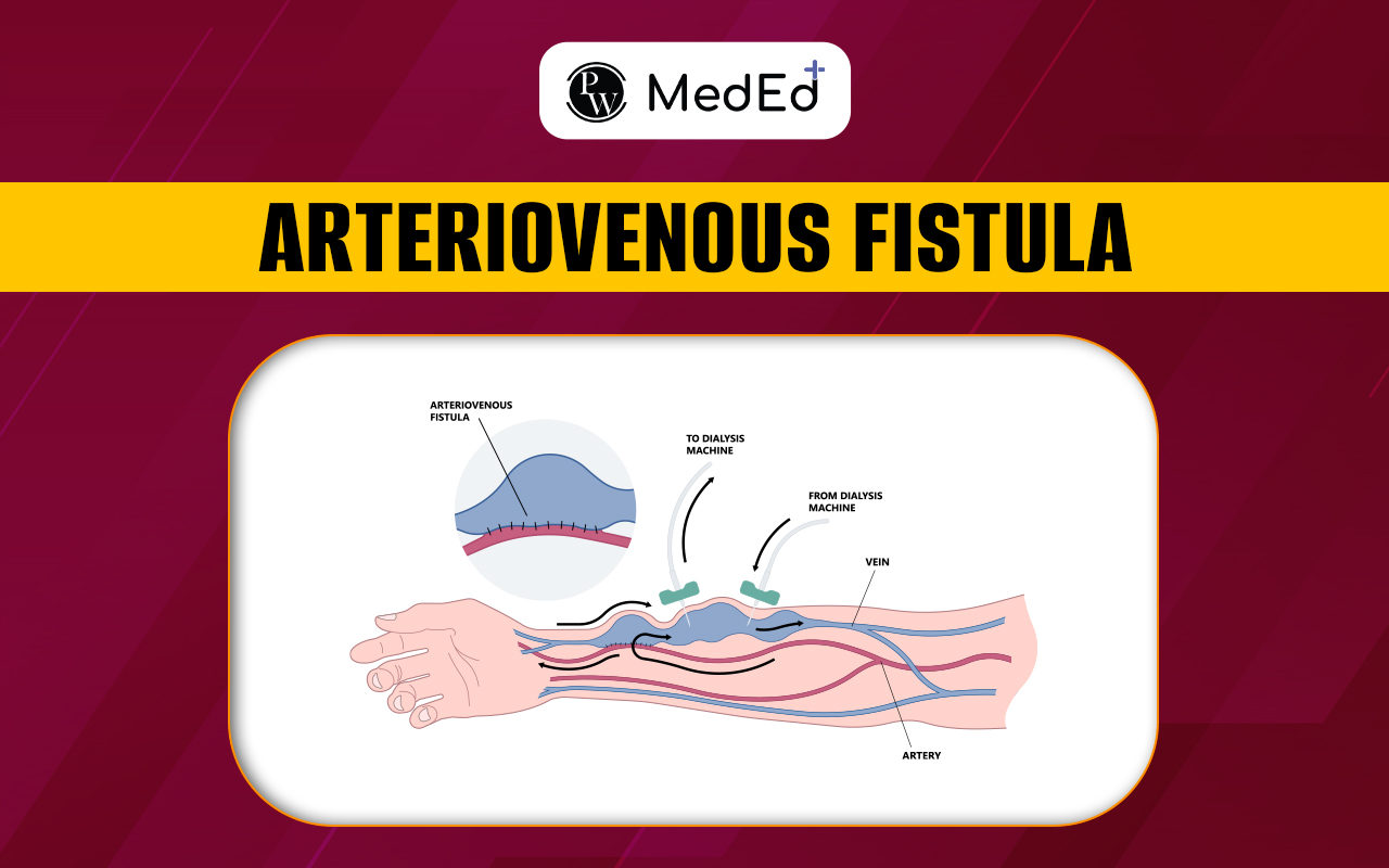 Arteriovenous Fistula, Symptoms & Causes