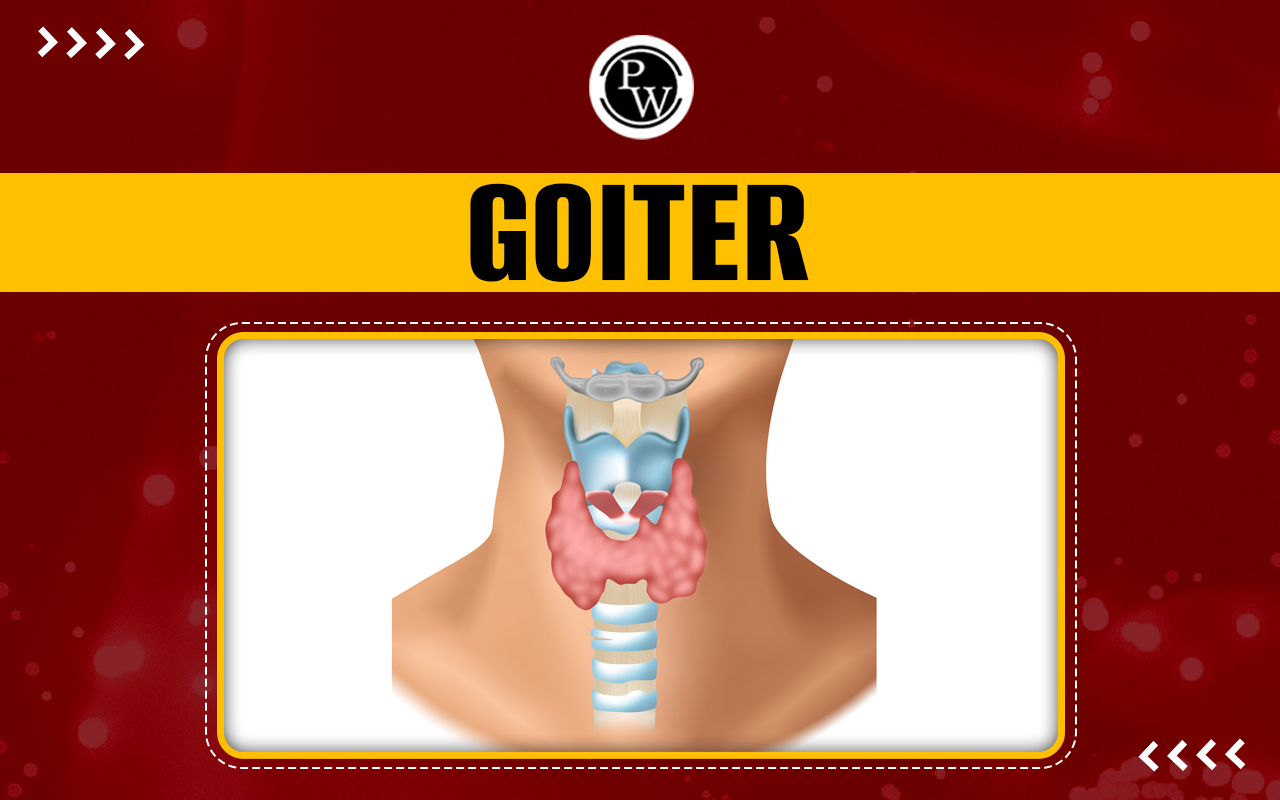 Goiter: Introduction, Types, Symptoms, Root Causes