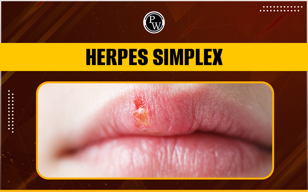 Herpes Simplex Introduction Causes Symptoms Treatment