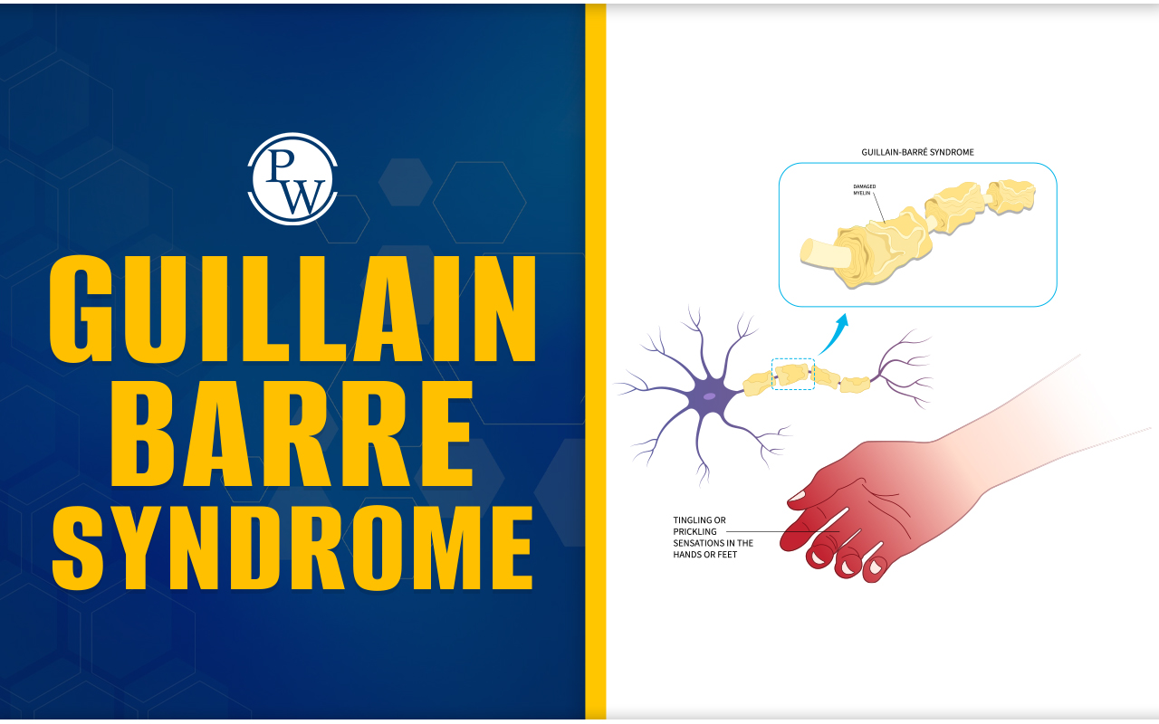 Guillain Barre Syndrome, Causes, Symptoms, Treatment