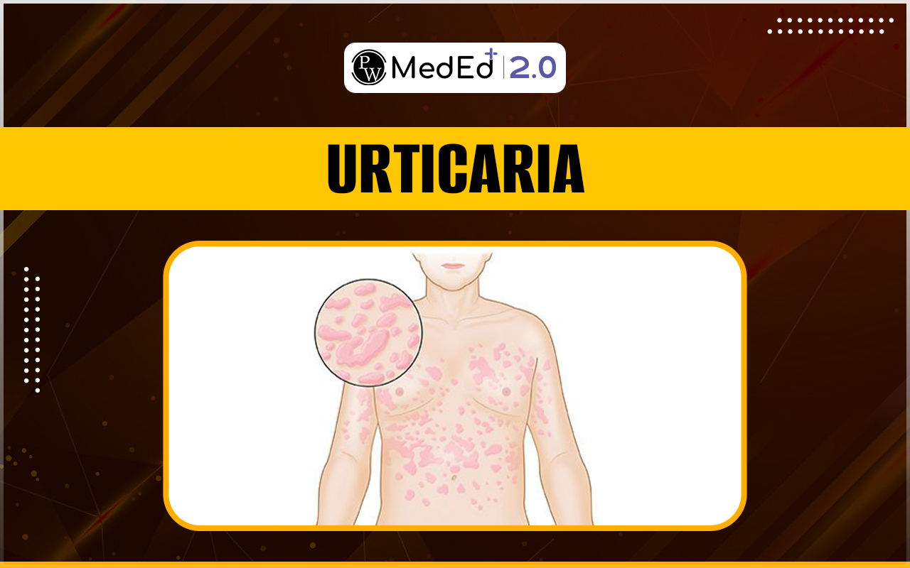 Urticaria Causes, Symptoms, Diagnosis, And Treatment Process