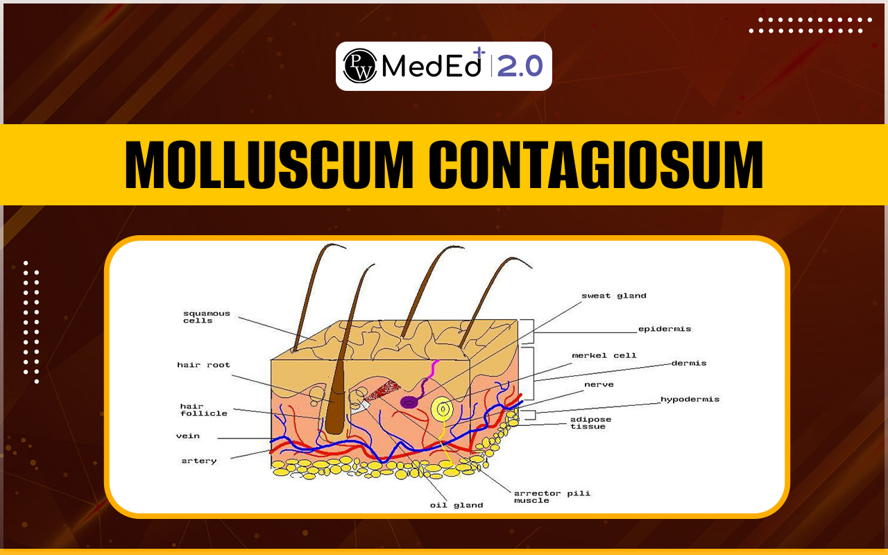 Molluscum Contagiosum Causes, Symptoms, Complications, And Treatment Process